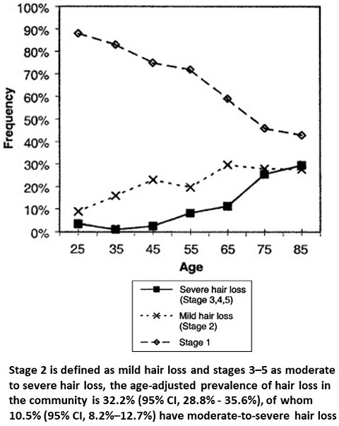 נשירת שיער: המגפה השקטה שמתפשטת במהירות - טבע בריא